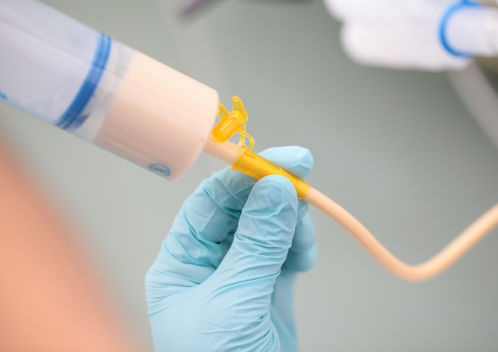 Adolescent Percutaneous Endoscopic Gastrostomy - Arisa